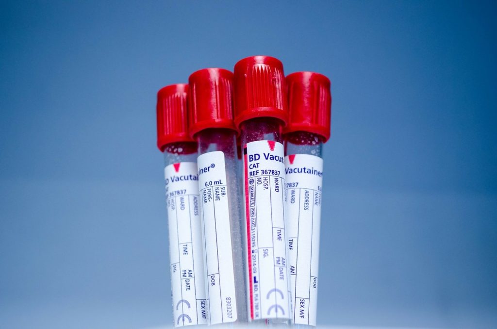 Drink or Drug Driving - The Second Sample - BSB Solicitors